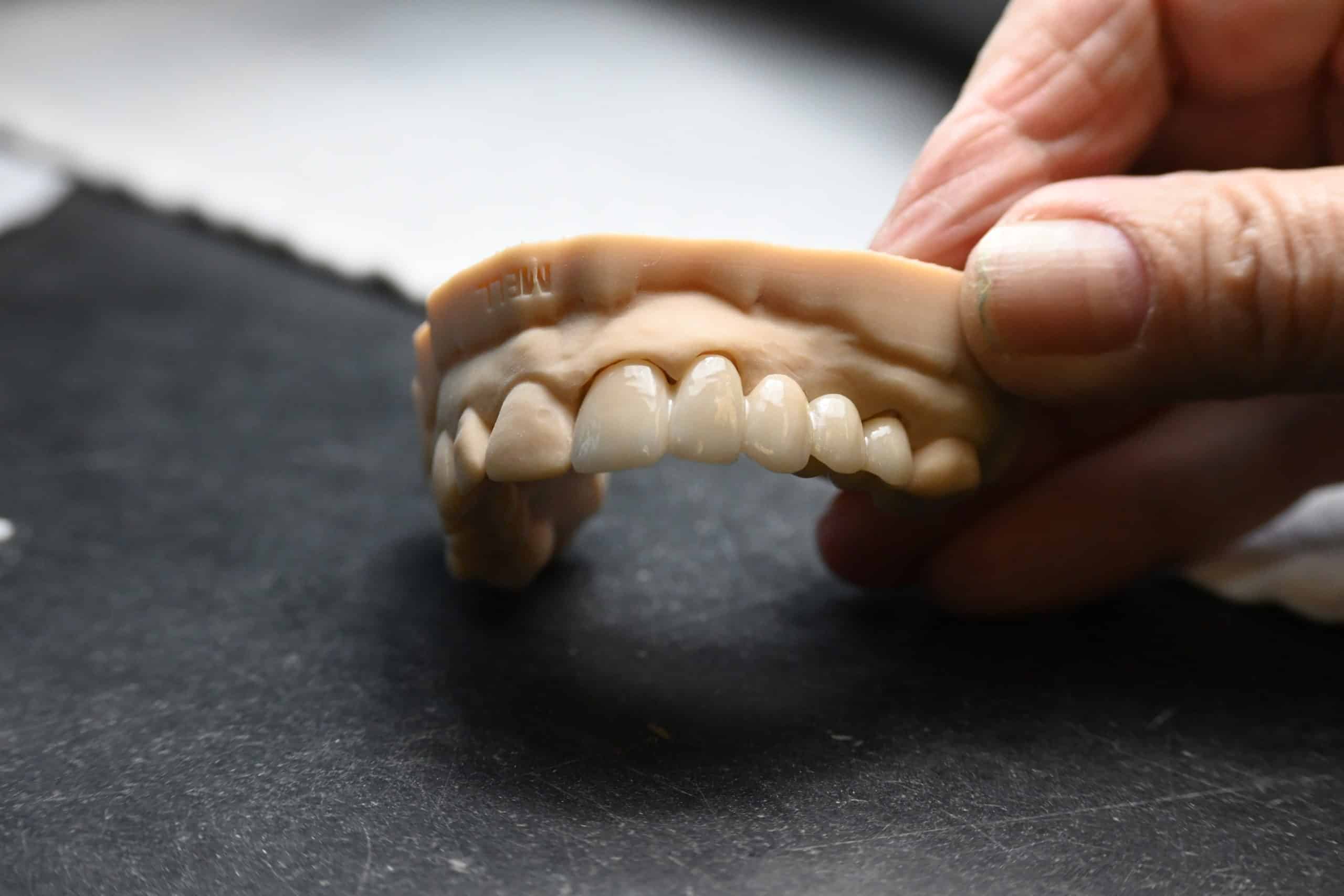 Shade Matching - VerTrue Dental Lab